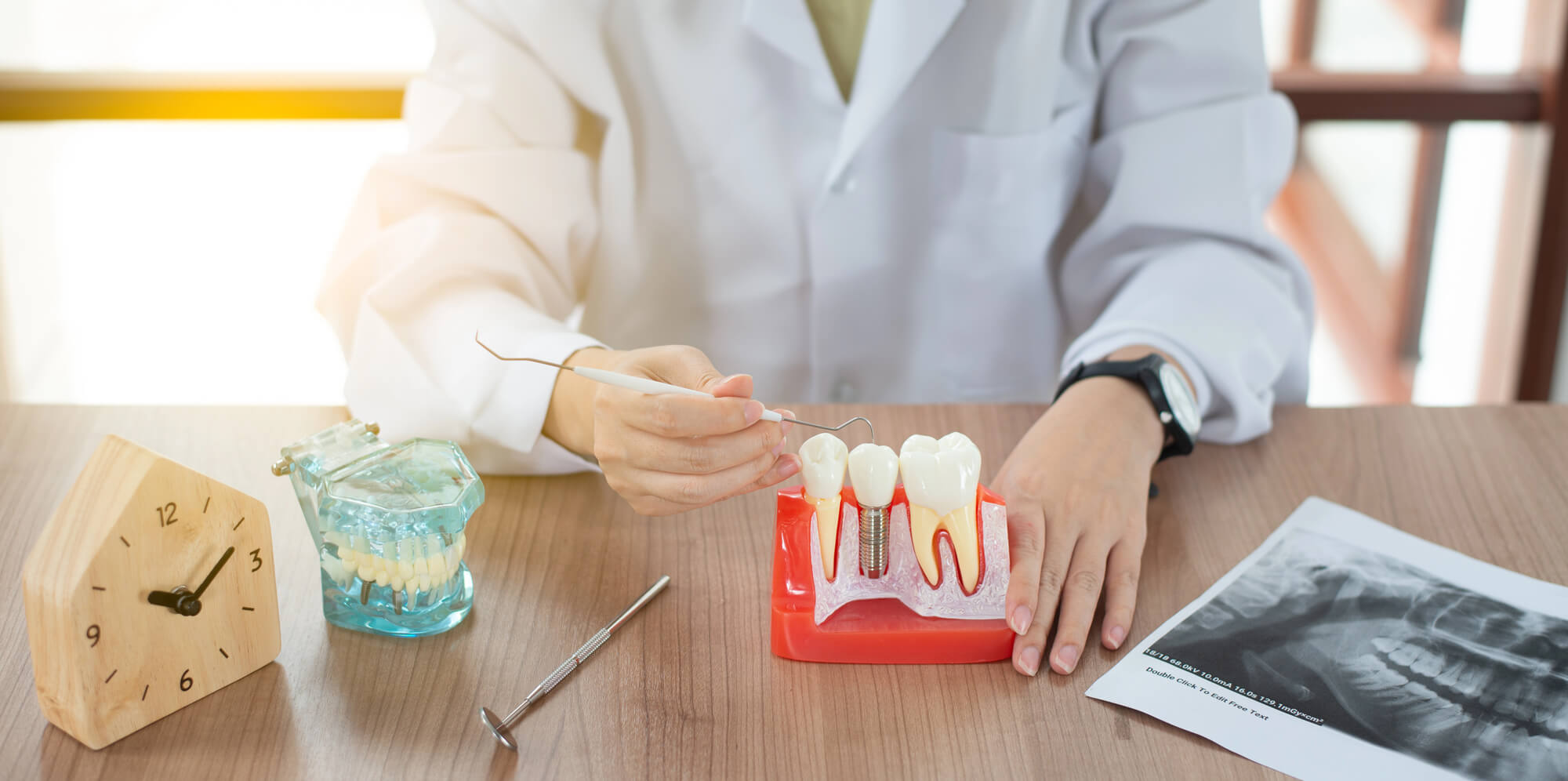 Durability of Titanium Dental Implants: What You Need to Know - 4M Dental